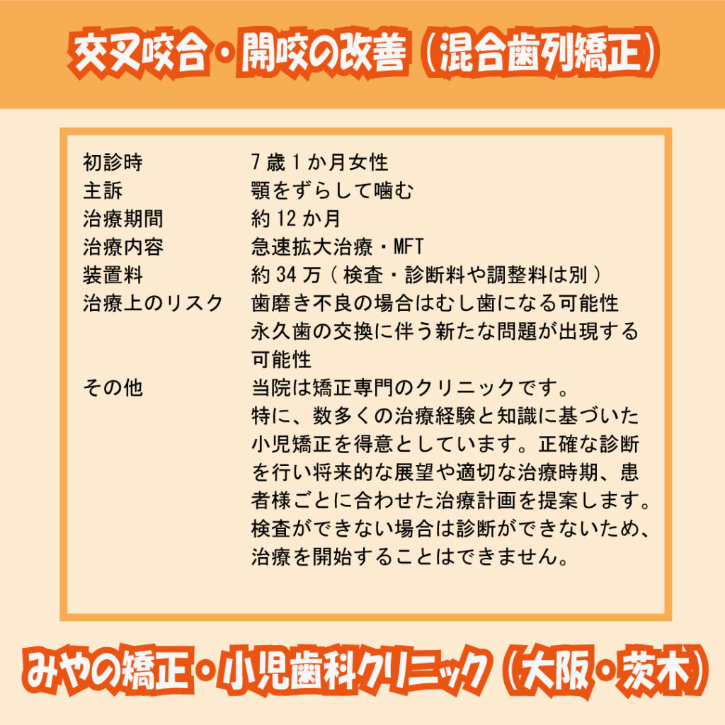 交叉咬合・開咬の矯正治療(混合歯列矯正) 矯正症例集 みやの矯正・小児歯科クリニック